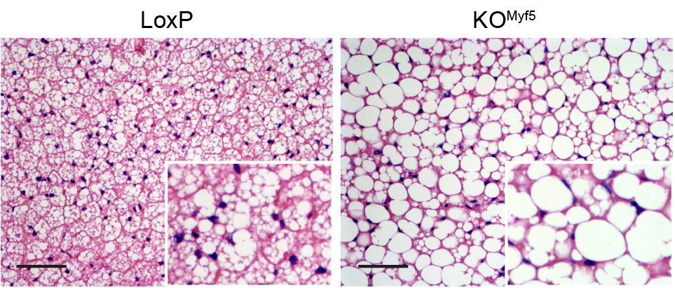 Brown Adipose Tissue